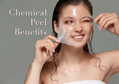 Chemical Peel Benefits You Are Missing Out On
