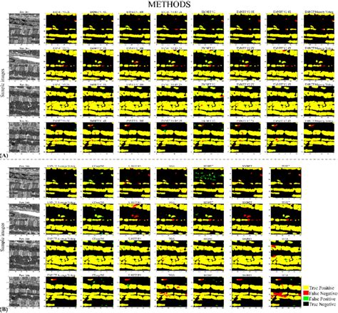 Comparison Of Segmentation Results On Cardiac Test Data Yellow Green