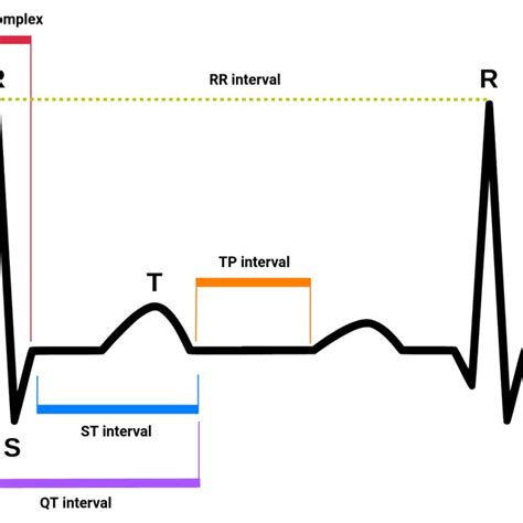 A Typical Ecg Signal With Its Most Common Waveforms Where Important Download Scientific