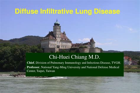 Ppt Diffuse Infiltrative Lung Disease Powerpoint Presentation Free