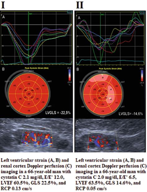 Imaging Examples Of Renal Cortex Perfusion In A Patient With Normal Download Scientific Diagram