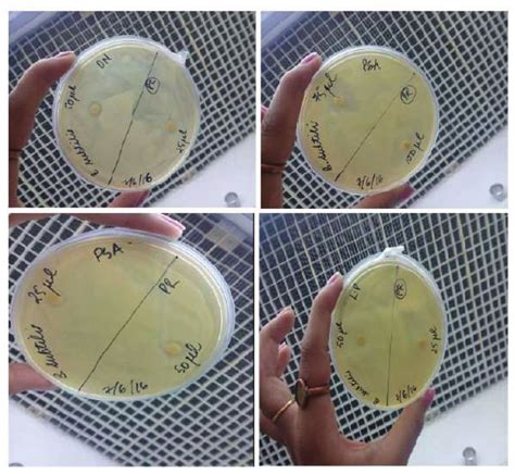 Antibacterial Activity Of Various Zinc Oxide Nanoparticles Against B