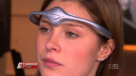 Cefaly Anti Migraineheadache Device On A Current Affair Youtube