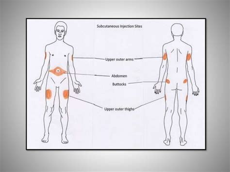 Intradermal And Subcutaneous Injectionpptx