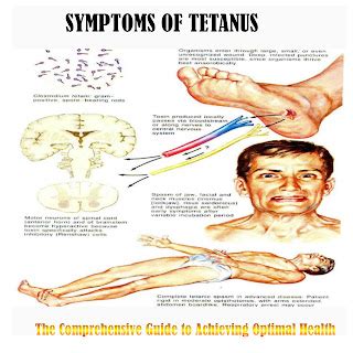 Tetanus Symptoms Recognizing The Signs Of A Silent Threat