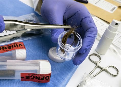 Hair Drug Test Process At Charles Rolle Blog