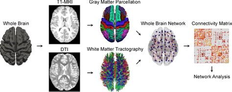 Brain Network Connectivity