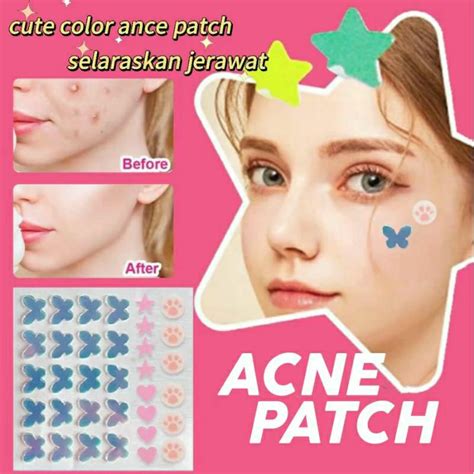 Jual Stiker Jerawat Hydrocolloid Acne Pimple Patch Colorful Acne Patch Jerawat Pimple Patch