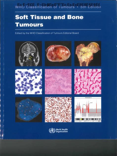 2020 Who Classification Of Soft Tissue And Bone Tumours Pdf Sarcoma