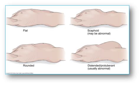 Health Assessment Abdomen Flashcards Quizlet