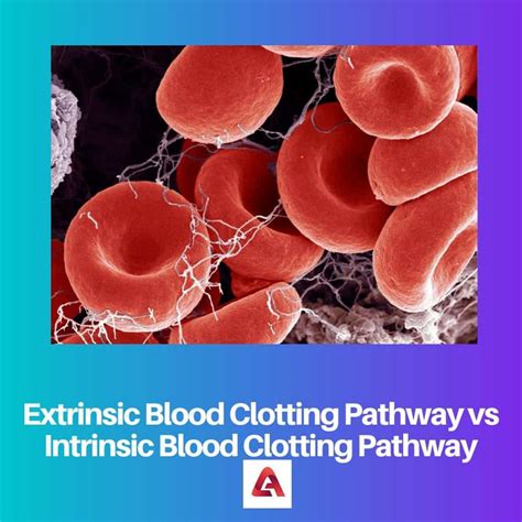 Usb Vs Scsi Difference And Comparison