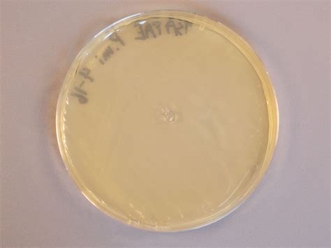 Proteus Classroom Bacterial Identification Wiki Fandom