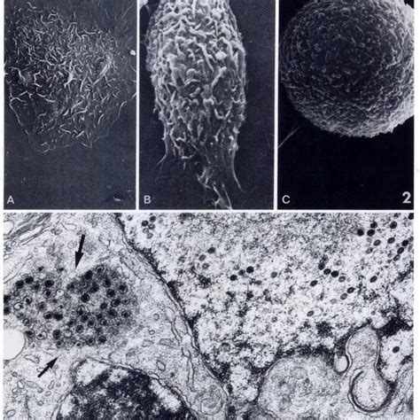 Transmission Electron Micrograph Of A Macrophage 3 D Pi A Large