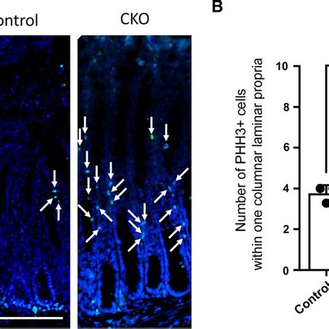 Tsc1 Deletion Leads To Increased Proliferation In The Mesenchyme Of Download Scientific Diagram