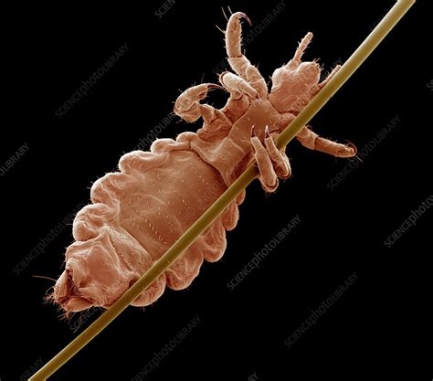 Lice Under Microscope