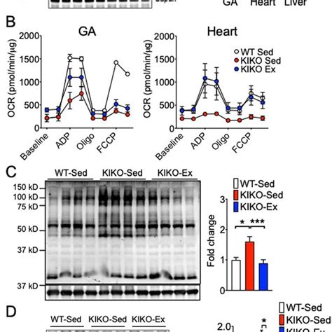 Long Term Voluntary Running Promotes Irp1 Expression And Mitochondrial