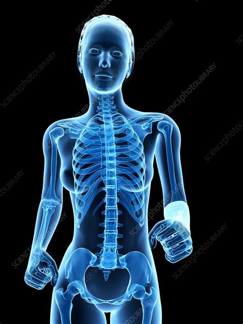 Female Skeletal System Illustration Stock Image F0108510