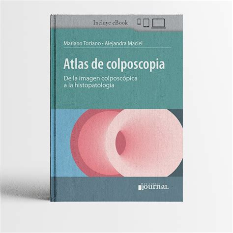 Libro Atlas De Colposcopia 1era Edición En Campus