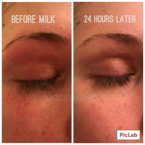 Eye Rash Eye Cream Milk Moisturizer From Maskcara Quick Fix Milk Moisturizer Northern Girls