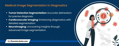 Medical Image Segmentation Revolutionizing Healthcare
