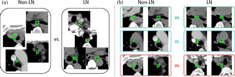 Figure 1 From Anatomy Aware Lymph Node Detection In Chest Ct Using