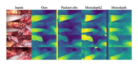 Qualitative Result Comparison Between Our Method Packnet 12