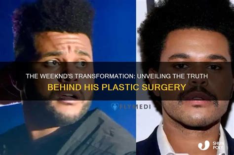 The Weeknds Transformation Unveiling The Truth Behind His Plastic Surgery Shunpoly