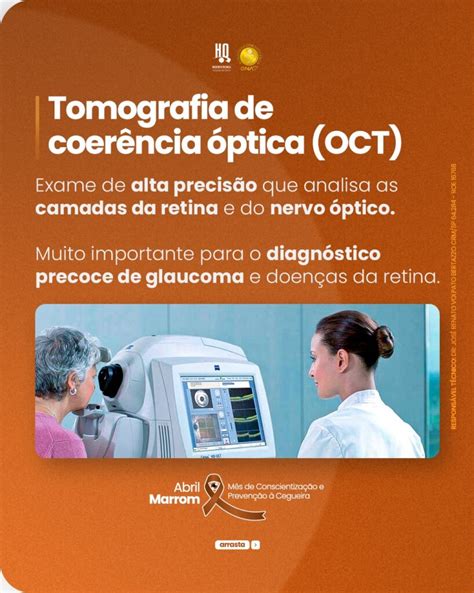 Exames Oftalmológicos Essenciais Para Cuidar Da Sua Visão Ho Redentora