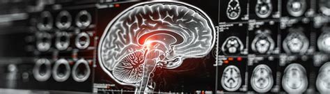 Mri Brain Scan Analysis Highlighting The Central Nervous System Advanced Medical Imaging For
