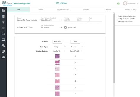 Detecting Breast Cancer With Deep Learning Kdnuggets