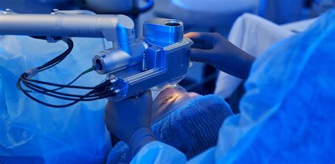Фемто Ласик Femto Lasik лазерная операция для коррекции зрения в Москве цены в клинике Эксимер