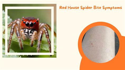 17 Types Of Spider Bite Symptoms Id With Pictures