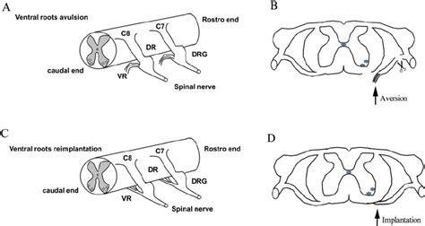Schematic Drawing Of The Avulsion And Acute Reimplantation Model A