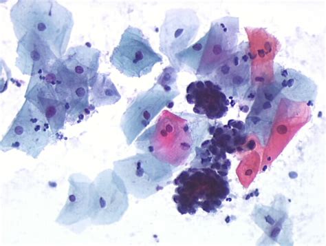 Normal Endometrial Cells