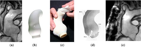 Pears Procedure At Buddy Byram Blog