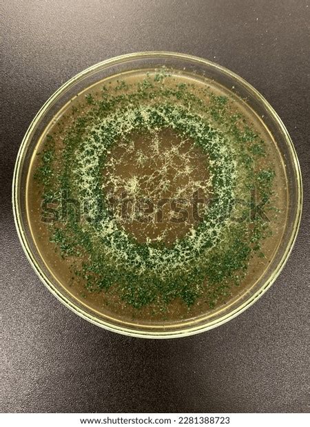 Categoría Hongo Trichoderma De Fotos E Imágenes Shutterstock