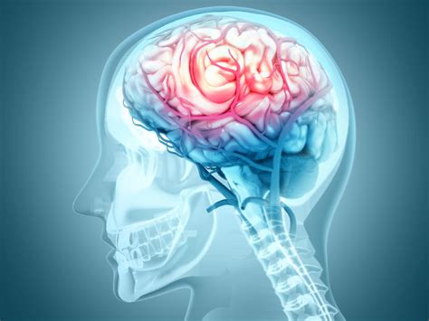 On Demand Webcast CCO