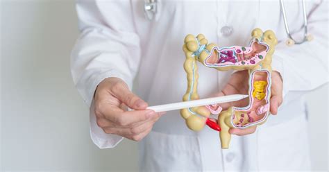 Colon Resection Also Known As Colectomy Is An Important Surgical Procedure That Involves