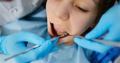 치과에서 치과 의사에게 치아를 검사받는 십대 소녀의 클로즈업 사진 Unsplash의 세르비아 이미지