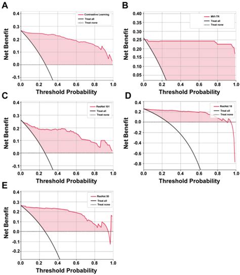 Mvi Tr A Transformer Based Deep Learning Model With Contrast Enhanced Ct For Preoperative