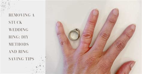 Removing A Stuck Wedding Ring Diy Methods And Ring Saving Tips