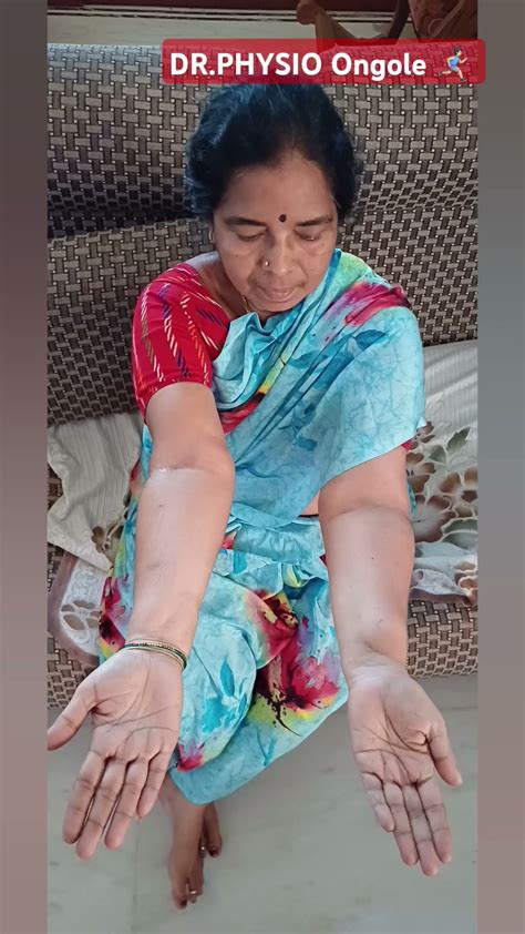 Distal End Of Humerus Bone Fractureandsurgery Progressive Rom With Dr