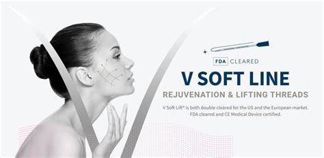 V Soft Lift Pdo Threads Finger And Associates Savannah Ga