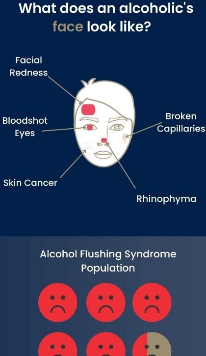 What Does An Alcoholics Face Look Like Abbeycare
