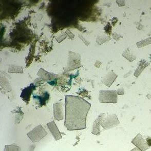 The Separation Of The Dye From The Polymer After Almost An Hour The Download Scientific