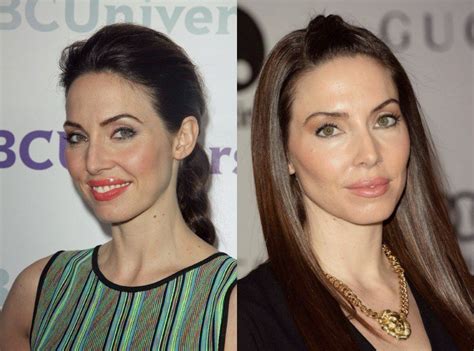 Whitney Cummings Plastic Surgery Everything You Should Know
