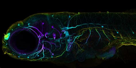 Developing Nervous System Of A Zebrafish Nikon Small World
