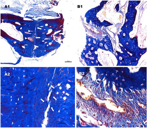 Photomicrographs Of The Bone Tissues Of From The Experimental Groups Download Scientific