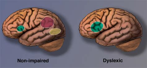 How The Brain Learns To Read Keys To Literacy