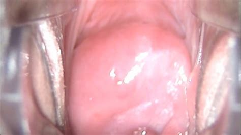Doctor Role Play Speculum In P View Inside P
